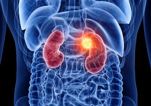 ¿Por qué se llaman El Niño y La Niña? Los fenómenos que alborotan el ...