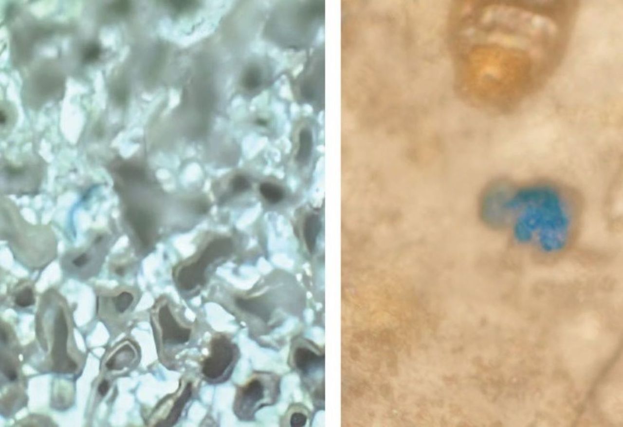 Microplastics found in the human brain: discovery worries researchers ...