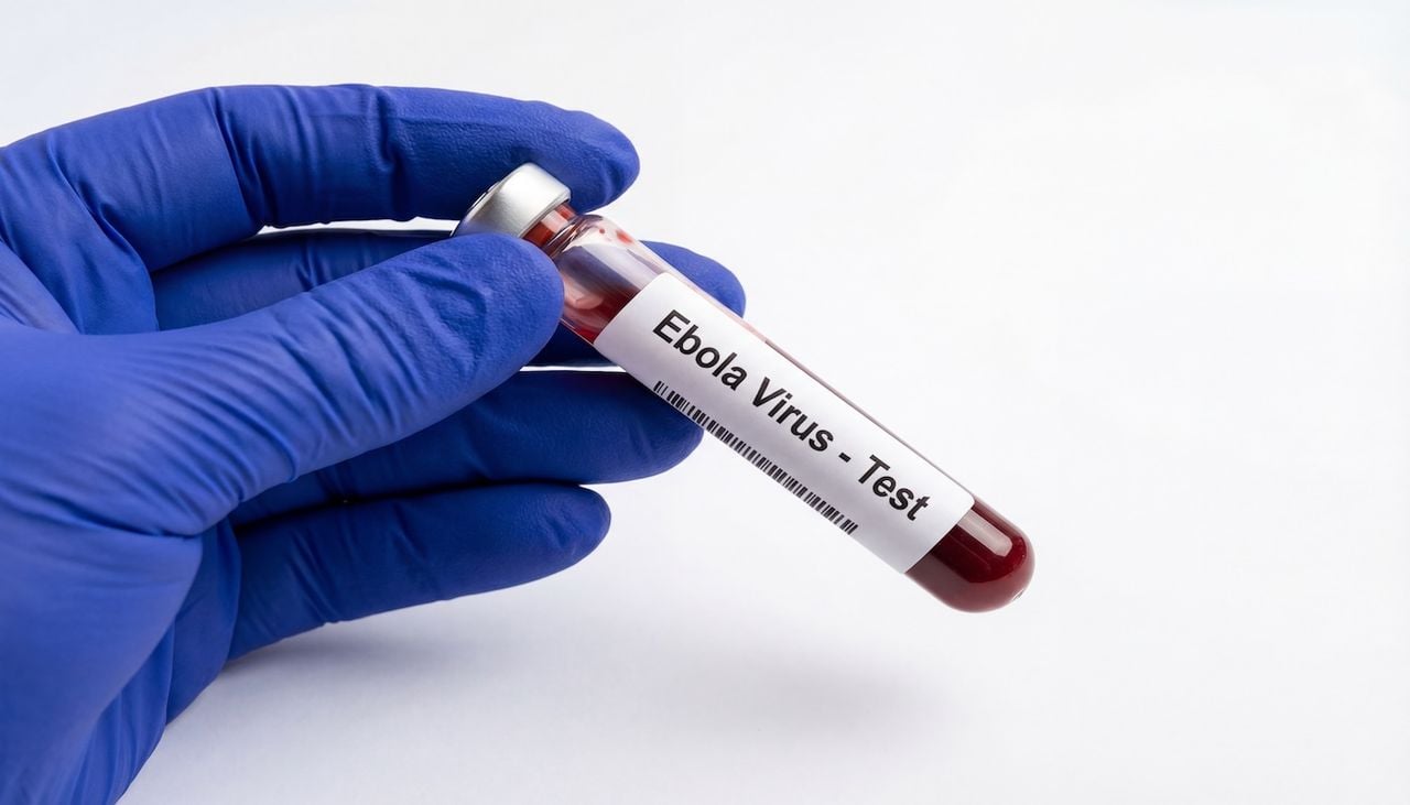 U.S. Deploys Public Health Officers to Kenya to Establish Quarantine ...