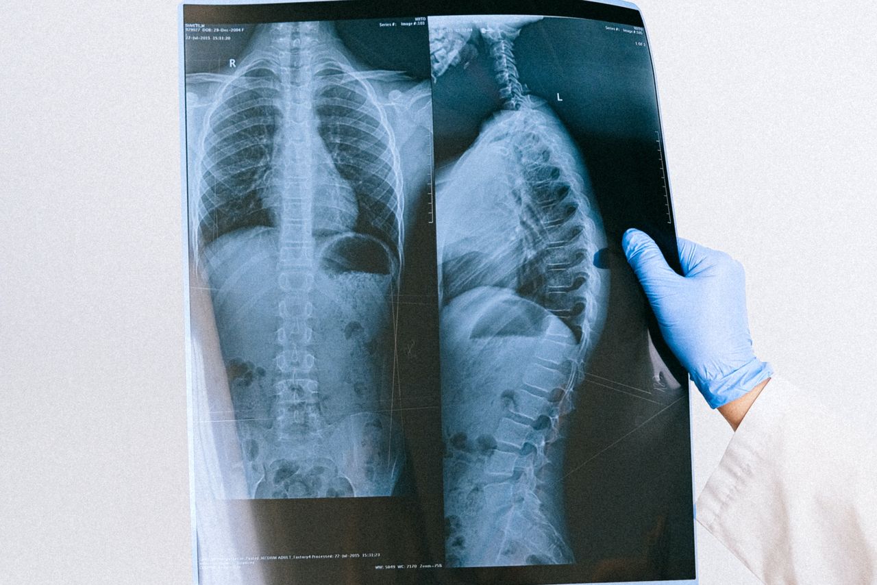 Using AI to Determine Your Biological Age